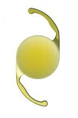 cataracte_implants - Portail du CHU 93